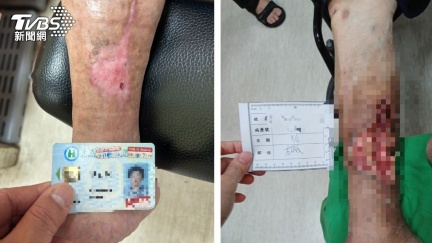 才宣布引退5天…27歲「超兇偶像」癌逝 醫嘆：早期難發現│TVBS新聞網