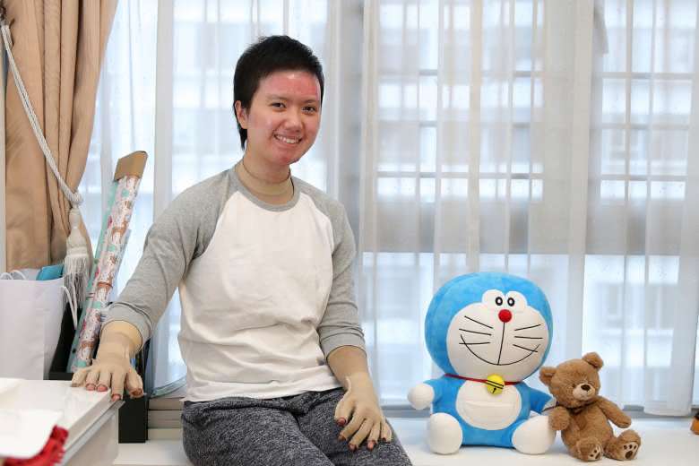 傷疤的激勵！八仙塵暴重傷女 成醫學系高材生│TVBS新聞網