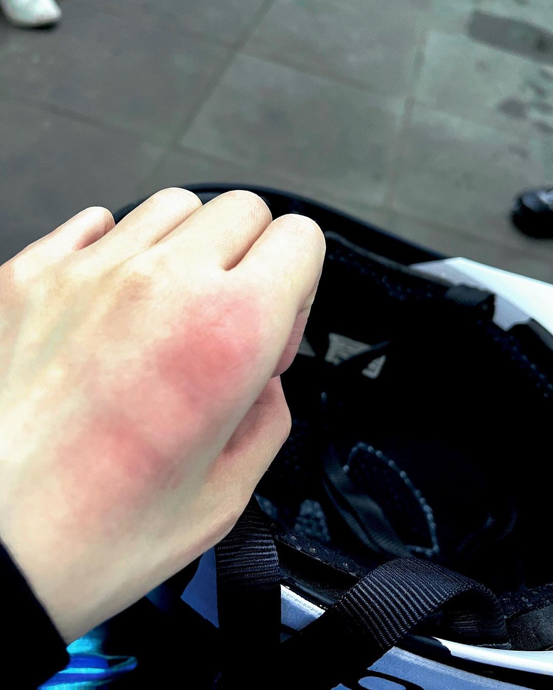 By2妹又送醫！Yumi傷勢照曝光：盡心盡力就沒遺憾│TVBS新聞網