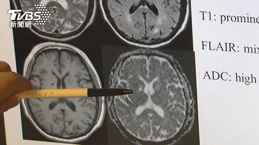 BA.5升溫中 本土+49540新北再破萬例│TVBS新聞網