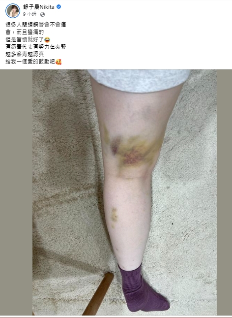 舒子晨磨嫩肉辣跳鋼管舞 拿皮膚當「煞車皮」美腿慘樣曝光│TVBS新聞網