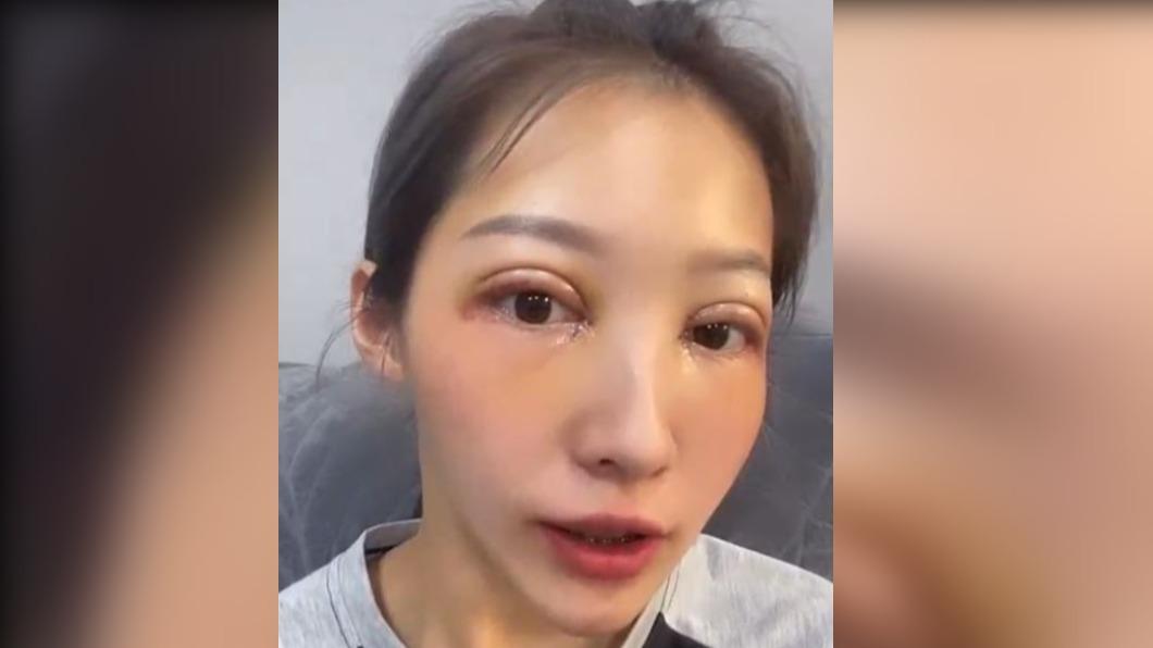 遭疑「變臉」！鳳梨女友嫩照驚人對比曝 認了唯一動刀部位│TVBS新聞網