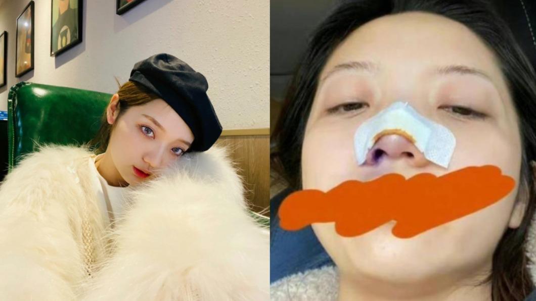 女星傳遭家暴！「板凳砸臉」險毀容 無奈嘆：從小就被打│TVBS新聞網