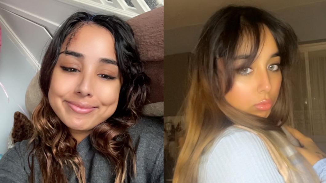 才開車回家！她自撞翻覆「髮夾嵌進腦」 30cm傷疤險毀容│鯊魚夾│Jeena Panesar│英國│TVBS新聞網