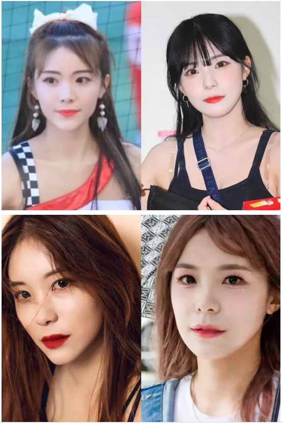 後天美女？李多慧「驚人對比照」流出 眼尖網揪1部位變了│TVBS新聞網