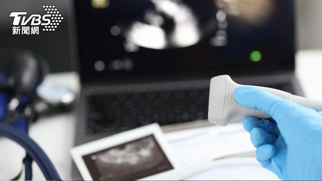 雙胞胎愈長大愈不像！人夫做DNA鑑定 罕見情況曝光了│TVBS新聞網