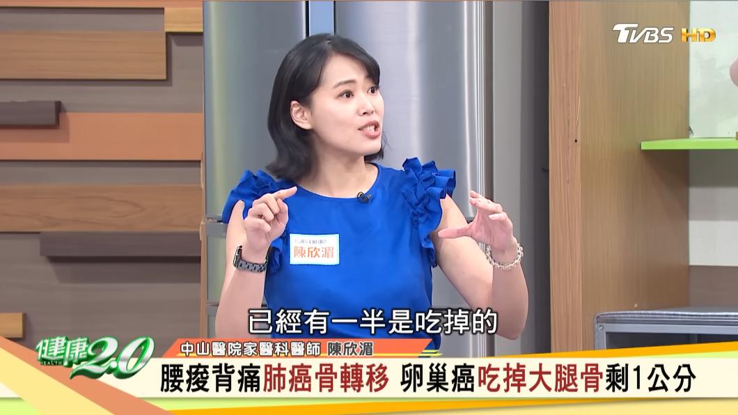 下公車不對勁！女X光一照「大腿骨吃掉一半」竟罹癌 醫嘆：轉移了│癌症│癌細胞│骨癌│TVBS新聞網