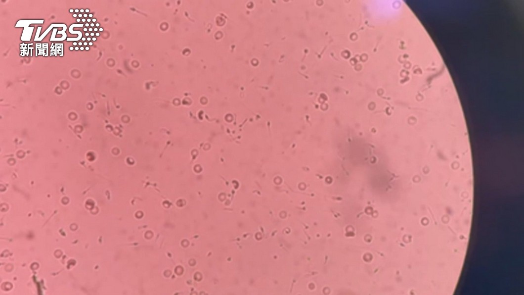 生不出來關鍵因素是「這件事」 醫師：別做NG行為│TVBS新聞網