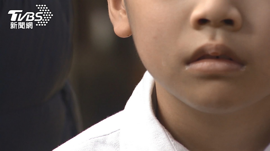 「3D列印」重建顴骨！ 6歲童成功抗「顏面腫瘤」│TVBS新聞網