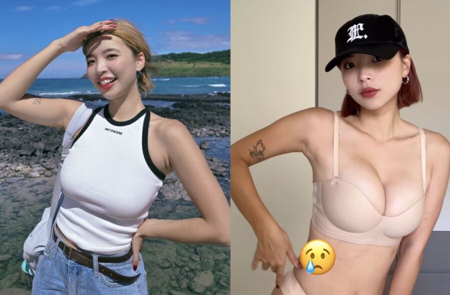 一隻阿圓「剩一顆腎臟」！驚罹癌症腫瘤切除續命 留傷疤近況曝│TVBS新聞網