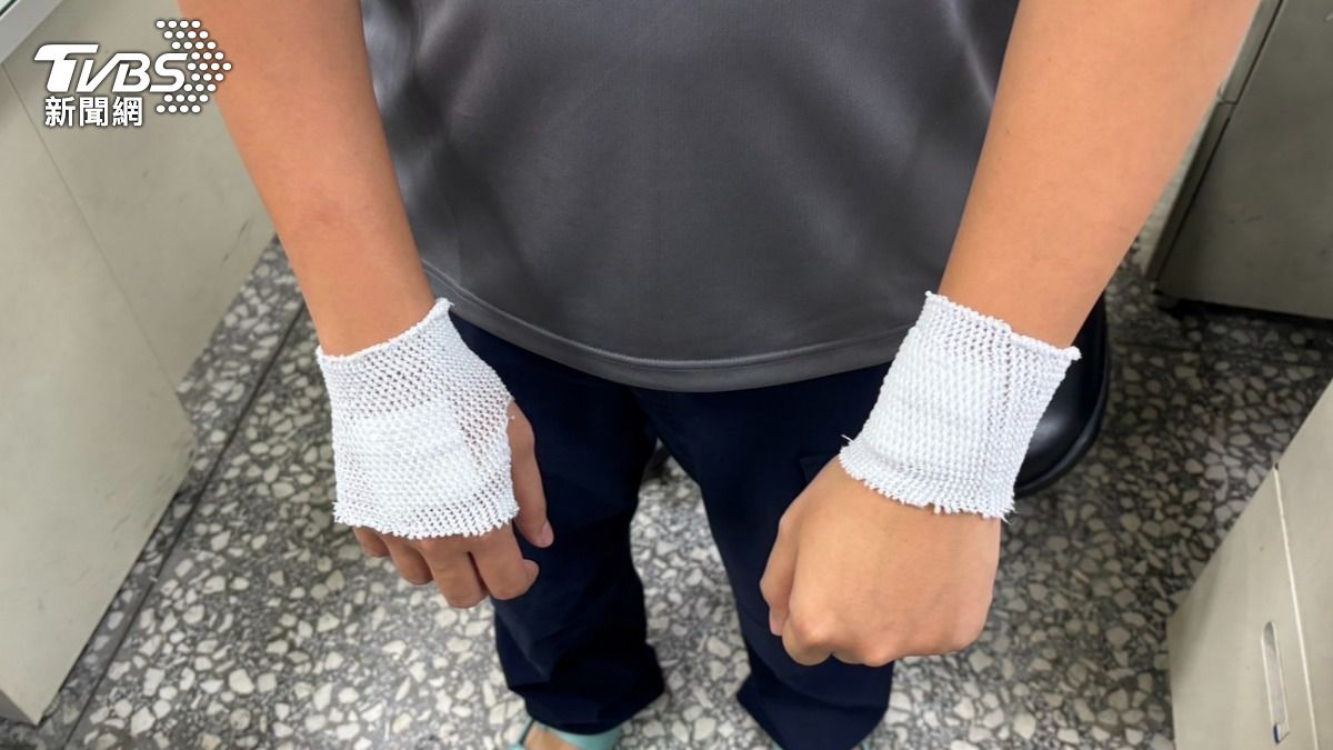 宜蘭情侶控警手銬打他們到「頭破血流」 警駁：絕無執法過當│TVBS新聞網