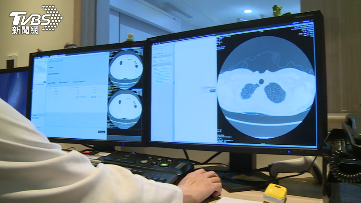 癌症鐘快17秒！每「4分2秒」1人罹癌 肺癌霸榜│TVBS新聞網