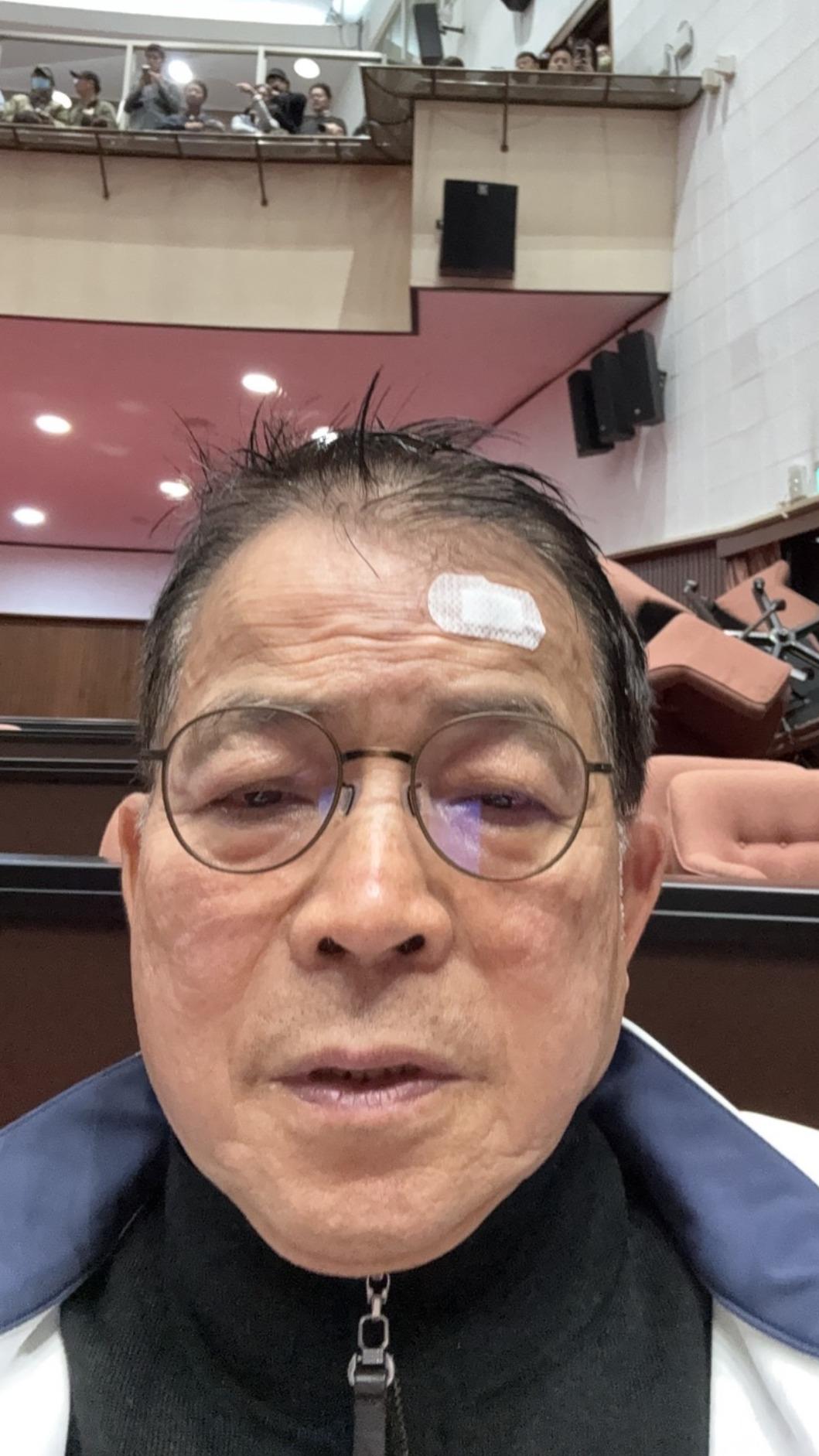 受傷不分藍綠！賴士葆遭椅子夾傷 「戰地醫師」綠委王正旭幫包紮│TVBS新聞網