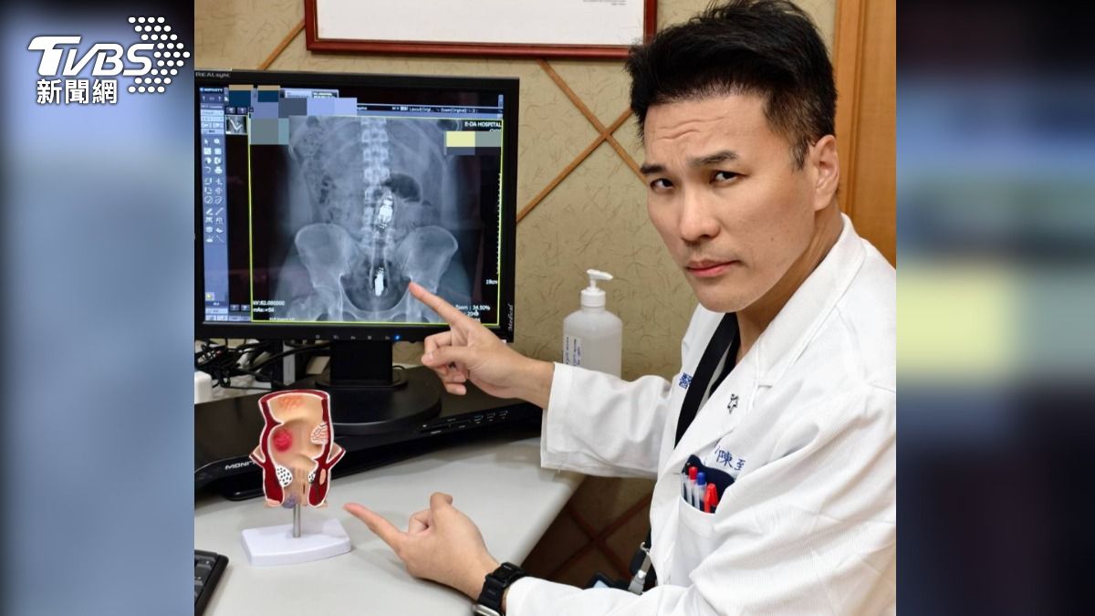 男男約戰「塞20cm異物」震整晚崩潰 醫生：卡直腸拉出還在動│TVBS新聞網