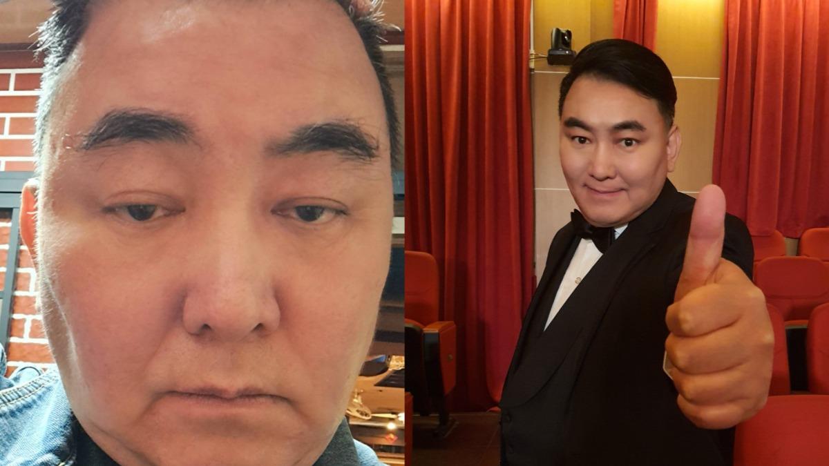 獨／徐亨暈倒送醫發現腦瘤！身體開「3洞」續命：能活多久不知道│TVBS新聞網