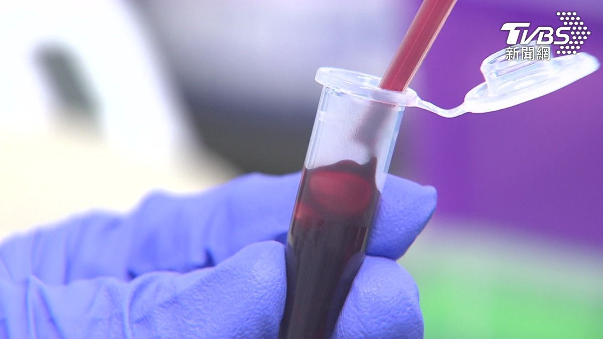 沈玉琳確診血癌！醫師曝「急性白血病需及時治療」持續發燒要注意│TVBS新聞網