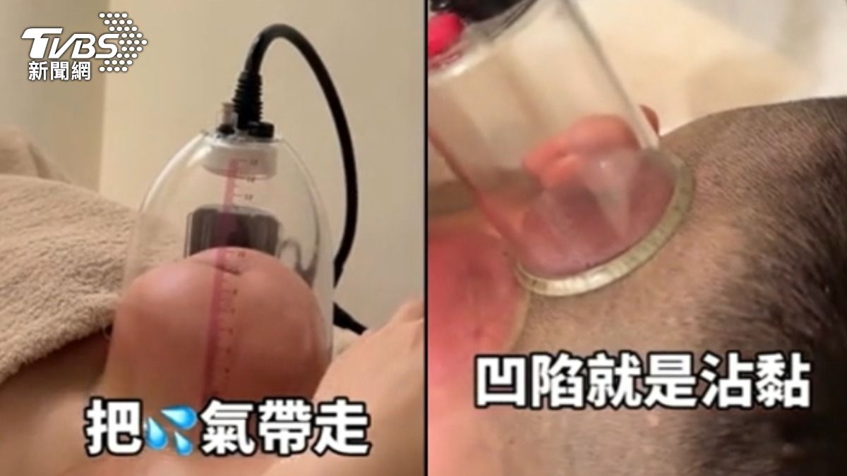 SPA業者活罐「皮肉吸到發紫」 中醫驚：危險│TVBS新聞網
