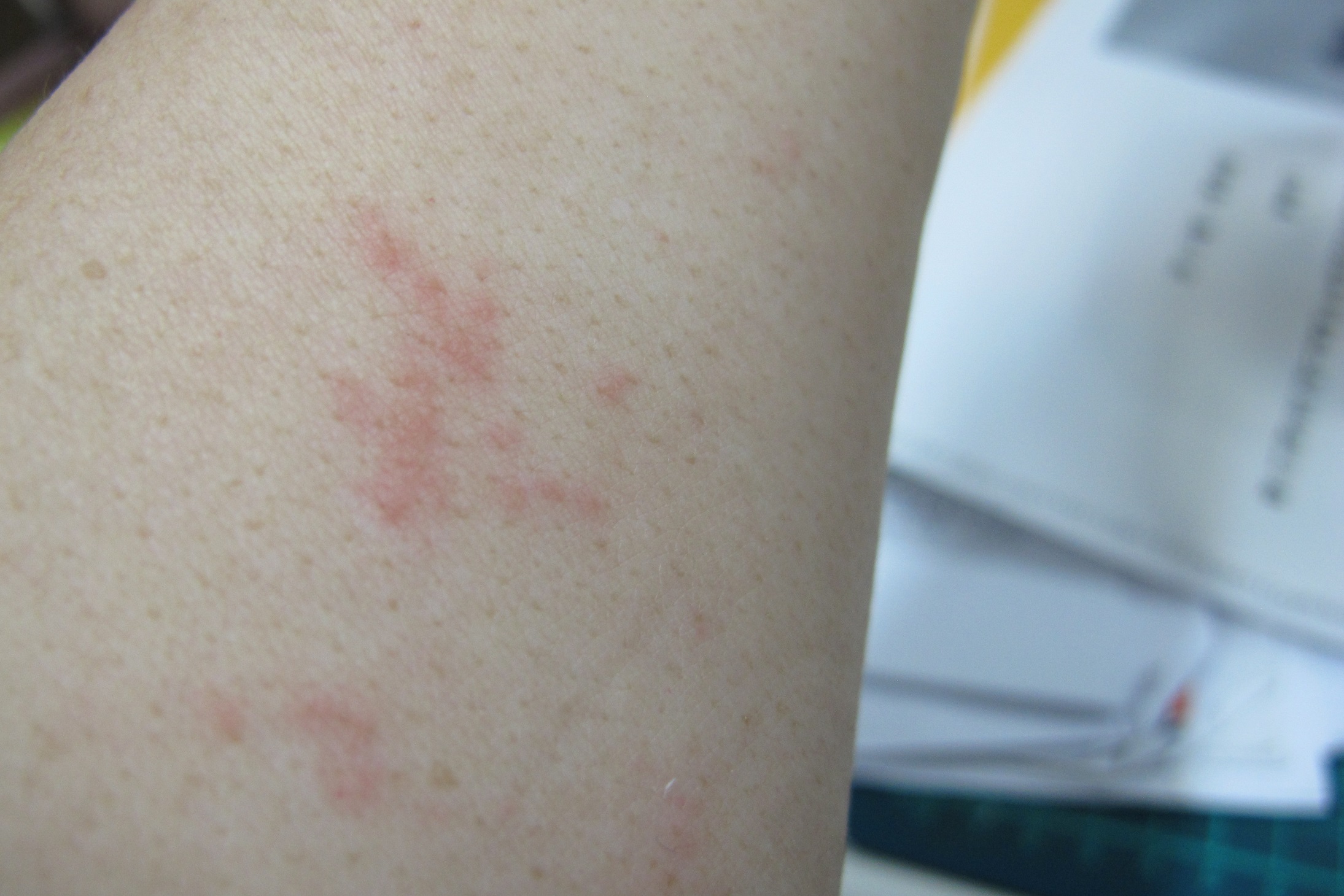 臭蟲床蝨危機！日本床蝨地圖必查，傷口特徵、長怎樣與防治全攻略│TVBS新聞網