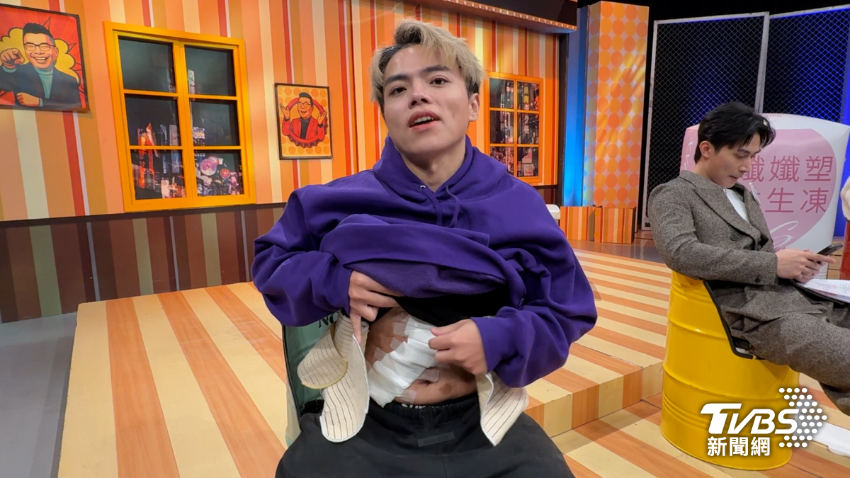 獨／海產「捐肝救父」出院首露面！30公分L形傷口曝 吐心聲：他已起好遺書│TVBS新聞網