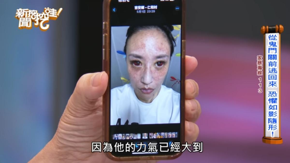 本土女星7年婚變！眼球暴血控老公「偷吃人妻」 昔甜讚2隻手握不住│TVBS新聞網