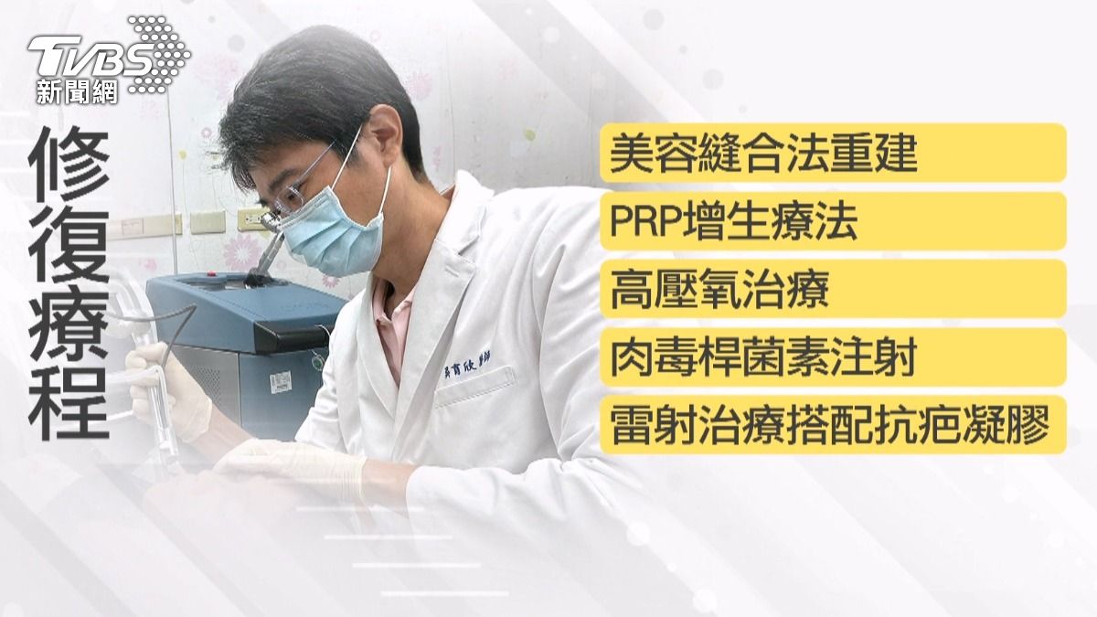 愛犬突翻臉！28歲女臉被咬掉4公分肉 「瘋柴」秒變暴君險毀容│TVBS新聞網