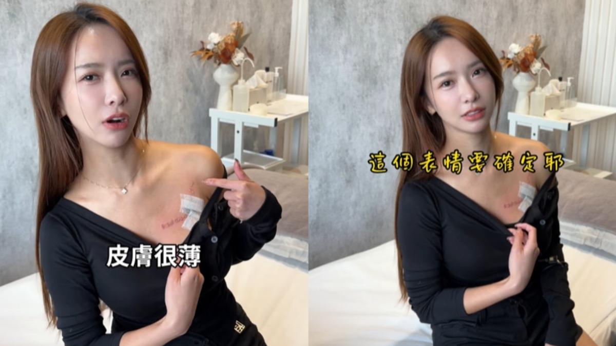 啦啦隊女神除刺青超煎熬！認了「影響工作」還身體乾淨 經紀人吐內幕│TVBS新聞網