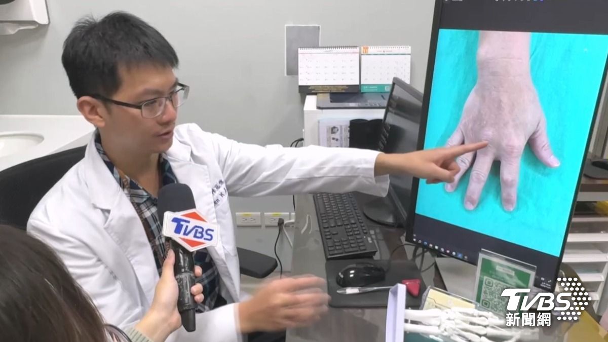 竹科男「手關節突起」影響活動 不是腫瘤是痛風石│TVBS新聞網