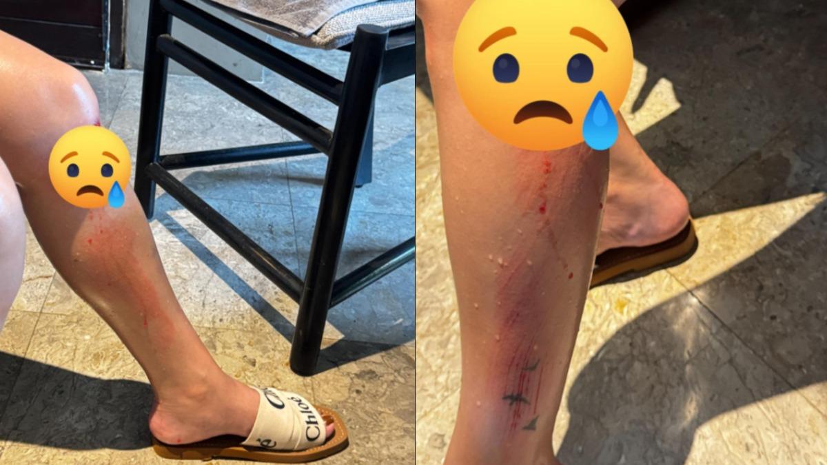 女CEO峇里島旅遊驚魂！岳啟儒踩空卡石縫半小時 出動電鑽救援│TVBS新聞網