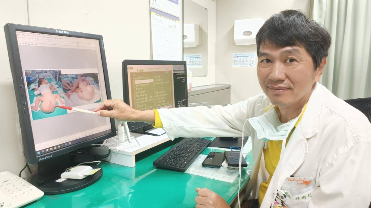 成因不明！台中女嬰患罕見畸胎瘤 出生「臀掛16公分巨球」│TVBS新聞網