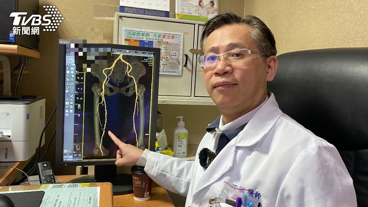 傷口快比健保卡大！七旬婦小腿「爛到見骨」 元凶藏在血管│TVBS新聞網