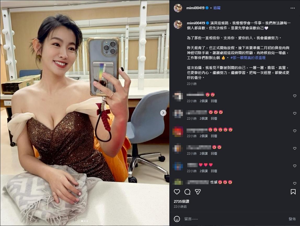 米可白「2月動刀切除神經」！曾拍戲一半大噴鼻血：每天頭痛│TVBS新聞網