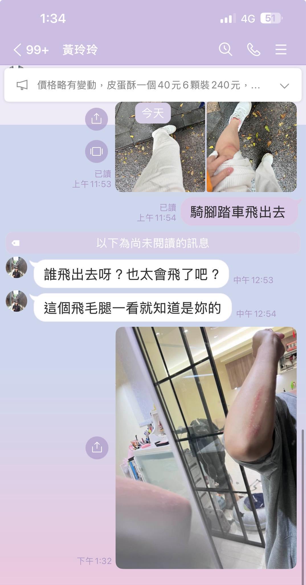 米可白「驚傳車禍」！整個人飛出去 大重摔挫傷│TVBS新聞網